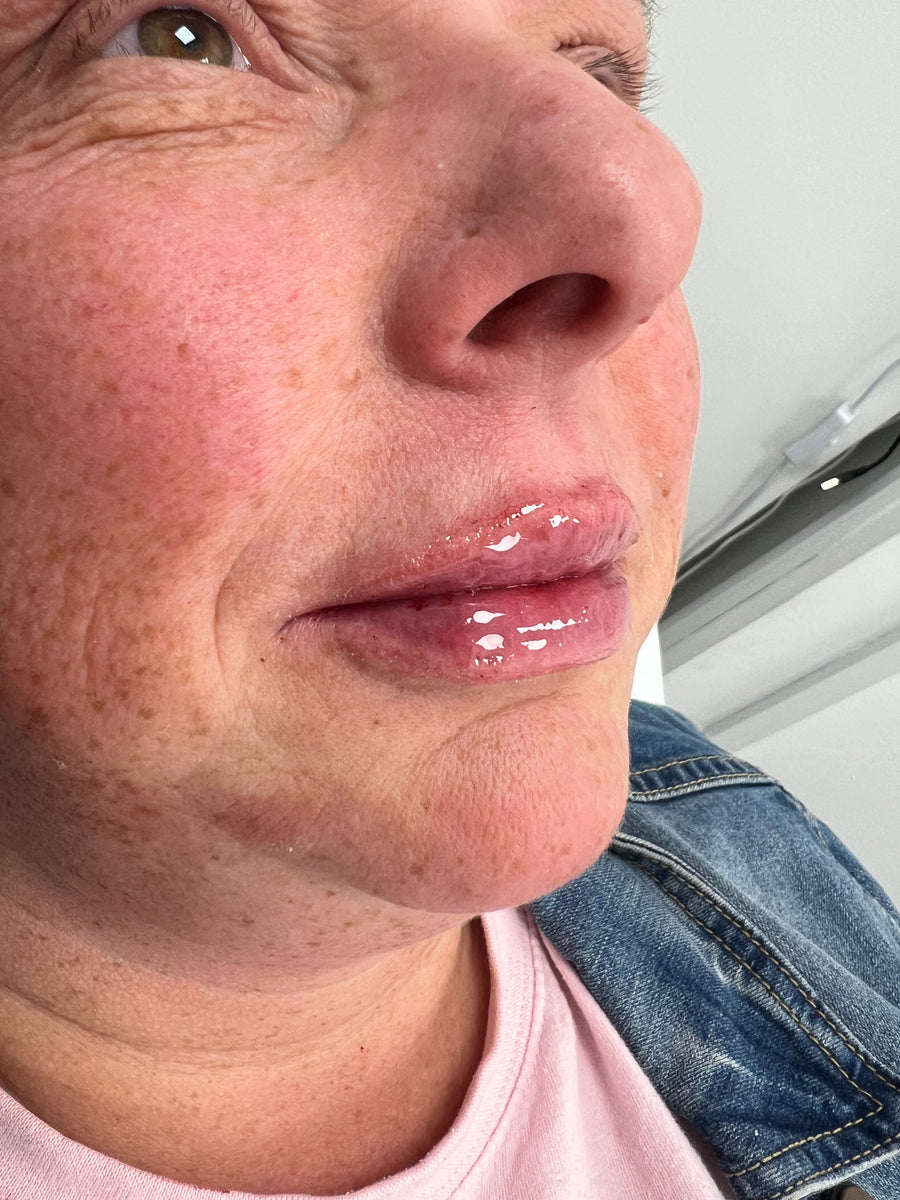 Lips – OH SO GLOW